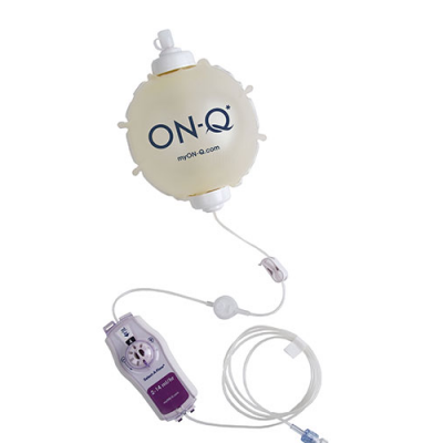 ON-Q* PUMP WITH SELECT-A-FLOW* VARIABLE RATE CONTROLLER - ProMed Ortho ...